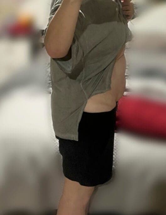 Weight Loss Services Online | Moshy